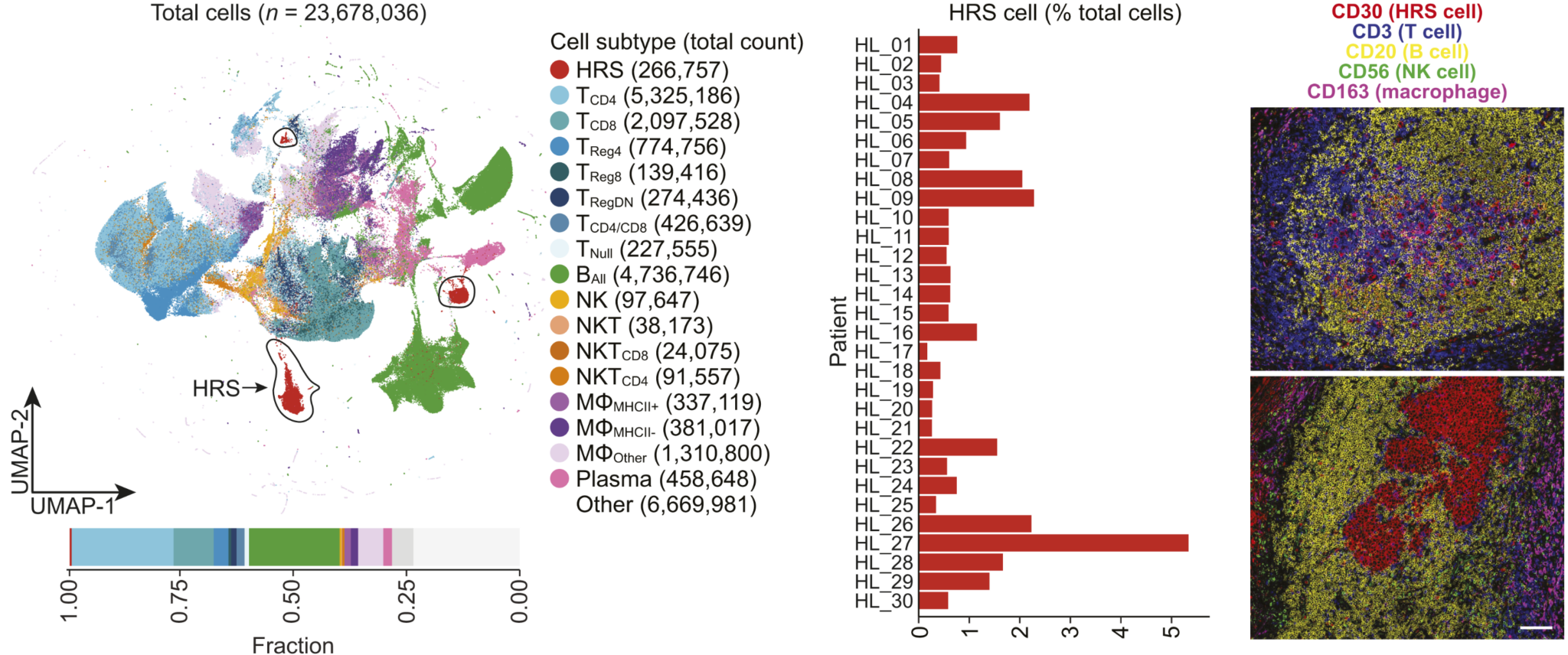 Deciphering Hodgkin’s lymphoma using spatial multi-omics Deciphering ...